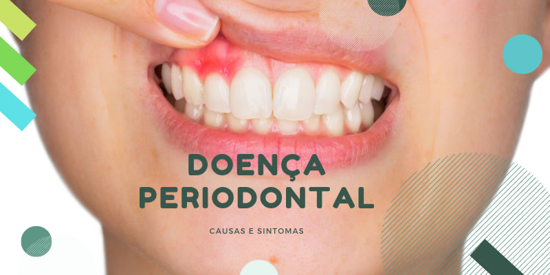 Doença Periodontal sintomas e tratamentos - Amo Odontologia